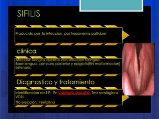 Laringitis cronica | PPTX