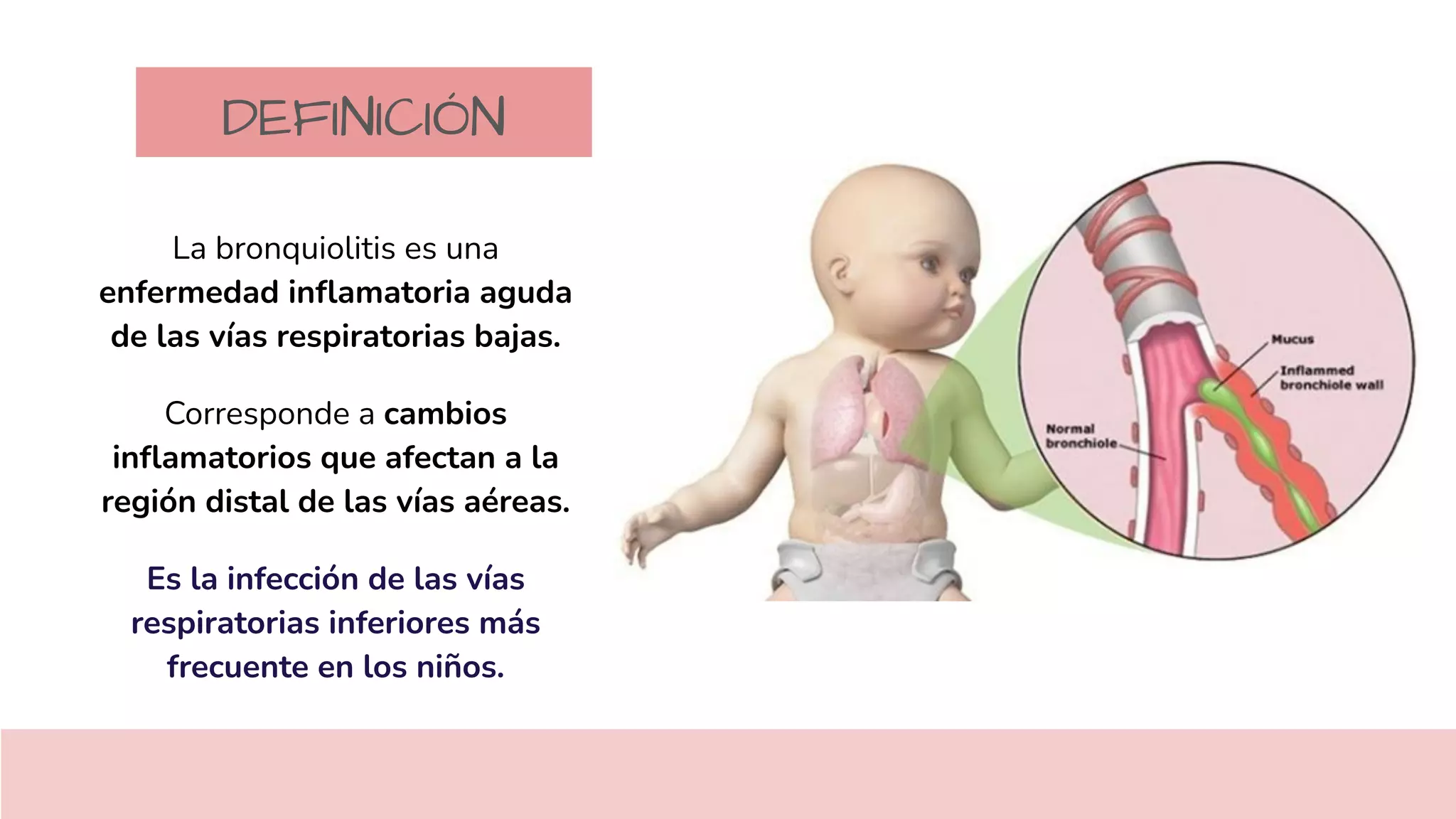 Laringitis Epiglotitis Y Bronquiolitis Pdf