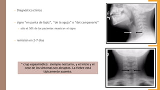Laringitis infecciosas eva | PDF