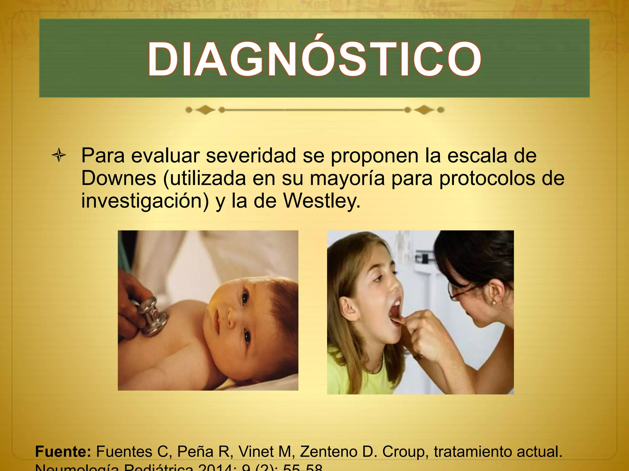 CRUP: Laringitis Pediatría | PPTX