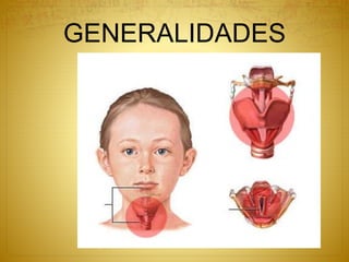 CRUP: Laringitis Pediatría | PPTX