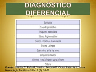 CRUP: Laringitis Pediatría | PPTX