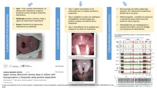 LARINGOMALACIA OTORRINOLARINGO 2025.pptx