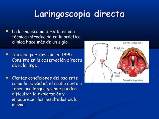 Laringoscopiacopia