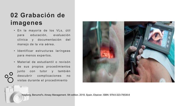LARINGOSCOPIA DIRECTA E INDIRECTA-criterios | PPT