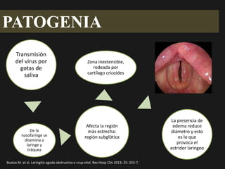 Laringotraqueitis Aguda (CRUP) | PPTX