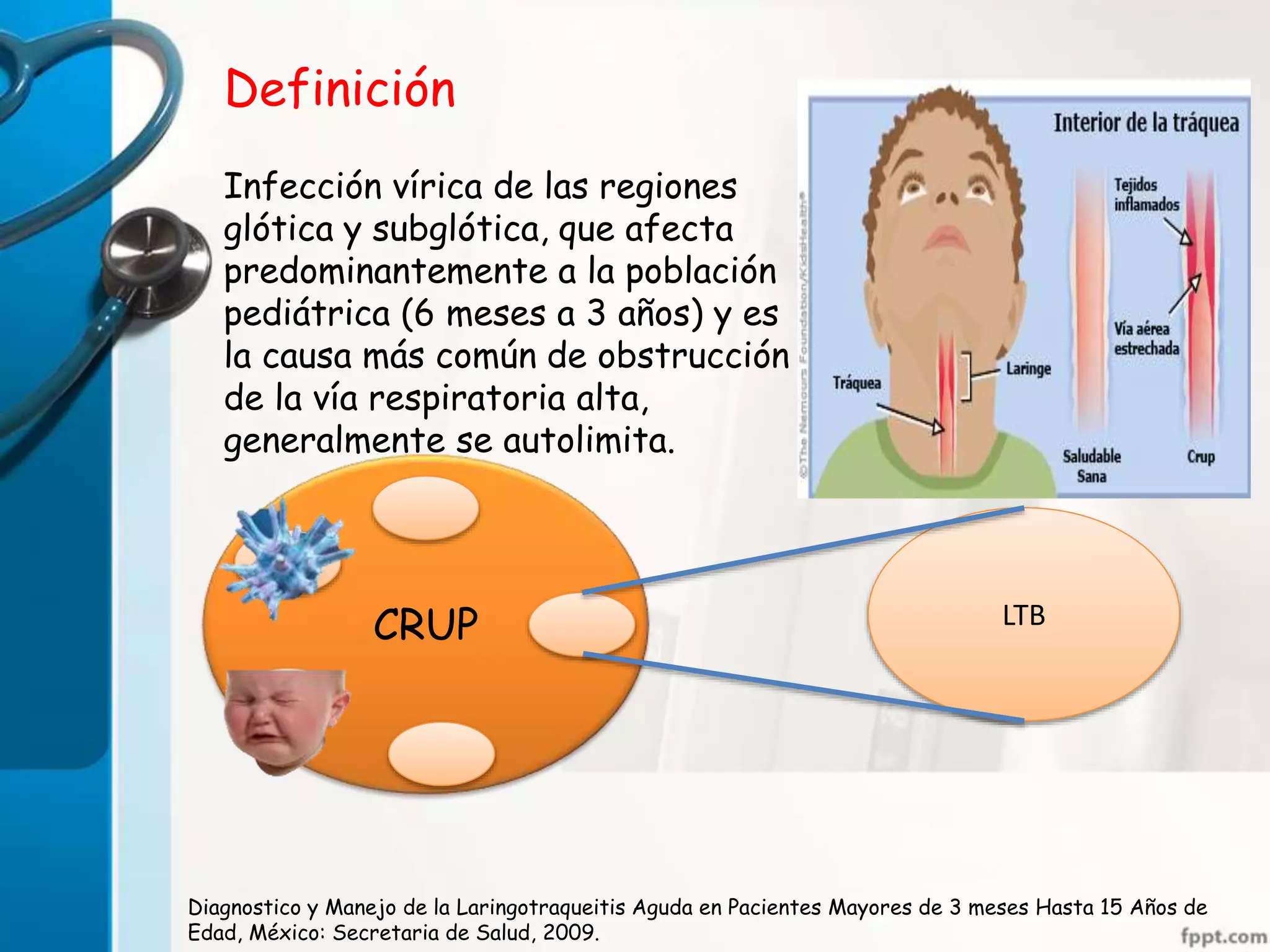 CRUP; Laringotraqueobronquitis | PPTX | Infectious Diseases | Diseases ...