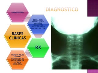 Laringotraqueobronquitis (crup) | PPTX