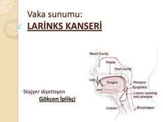 Larinks kanseri vaka inceleme sunumu ve beslenme tedavisi | PPTX