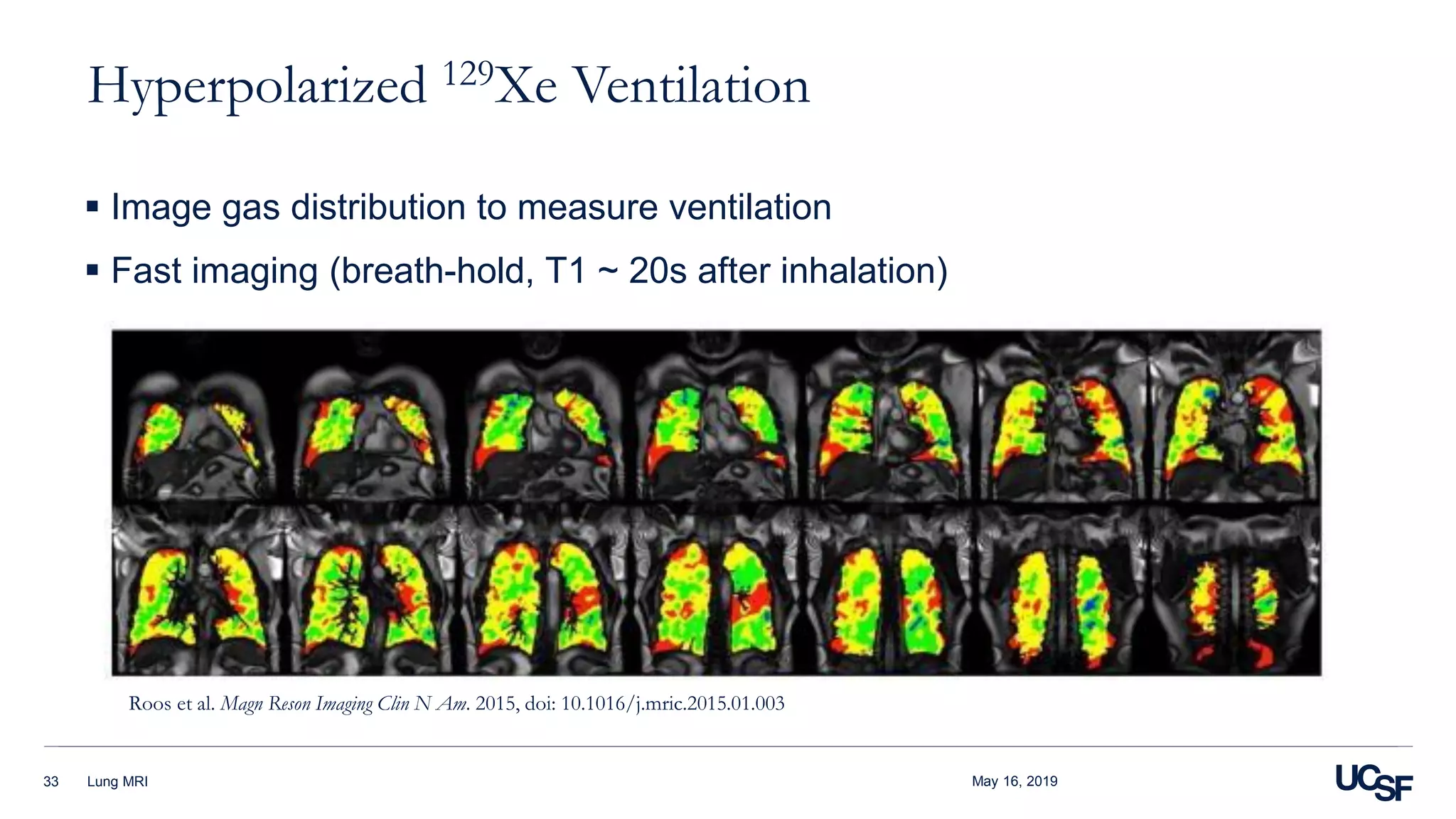 Lung MRI | PDF