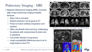 Lung MRI | PDF