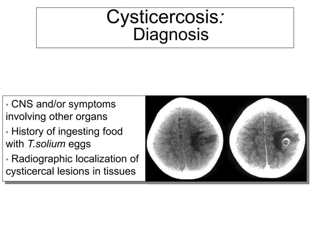 Larval cestodes who cause diseases to humans | PPT