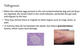 Larva migrans | PPTX