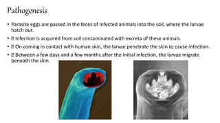 Larva migrans | PPTX