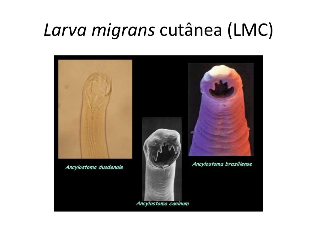 Larva migrans cutânea e visceral