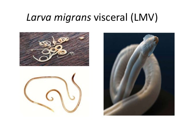 Larva migrans cutânea e visceral