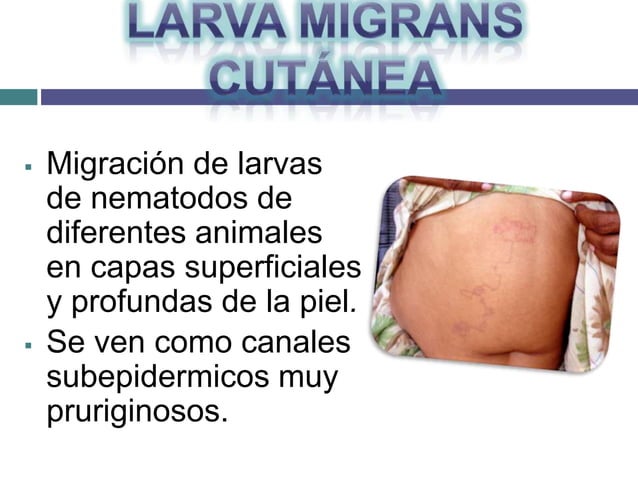 Larva migrans cutánea y visceral | PPTX