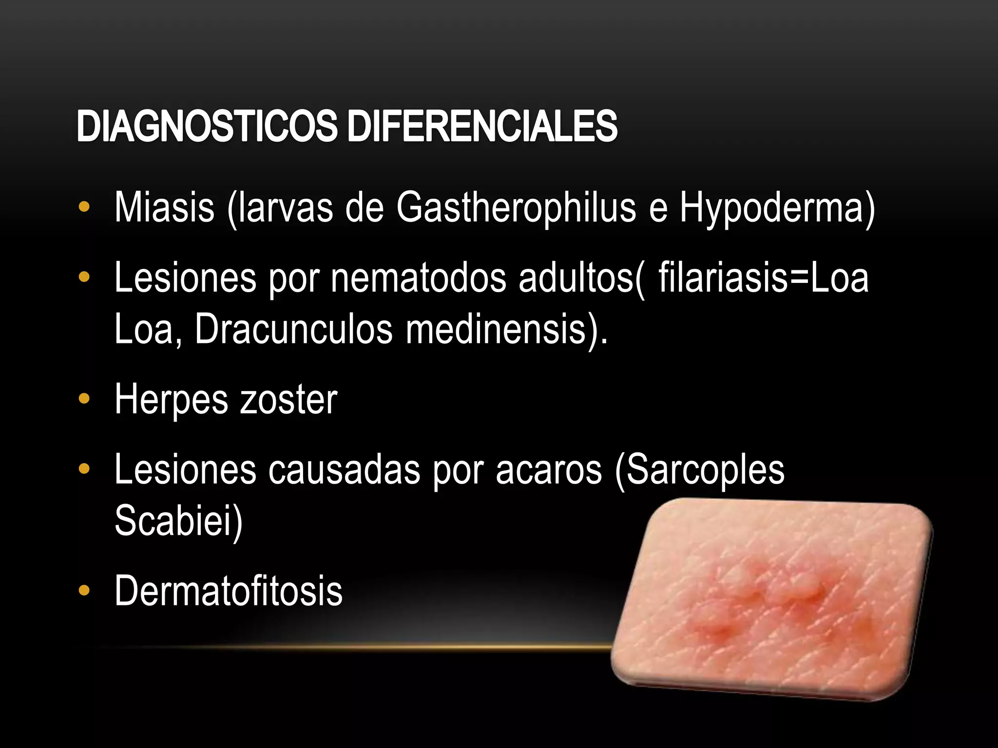 Larva migrans cutánea y visceral | PPT