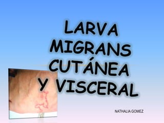 Larva migrans cutánea y visceral | PPTX