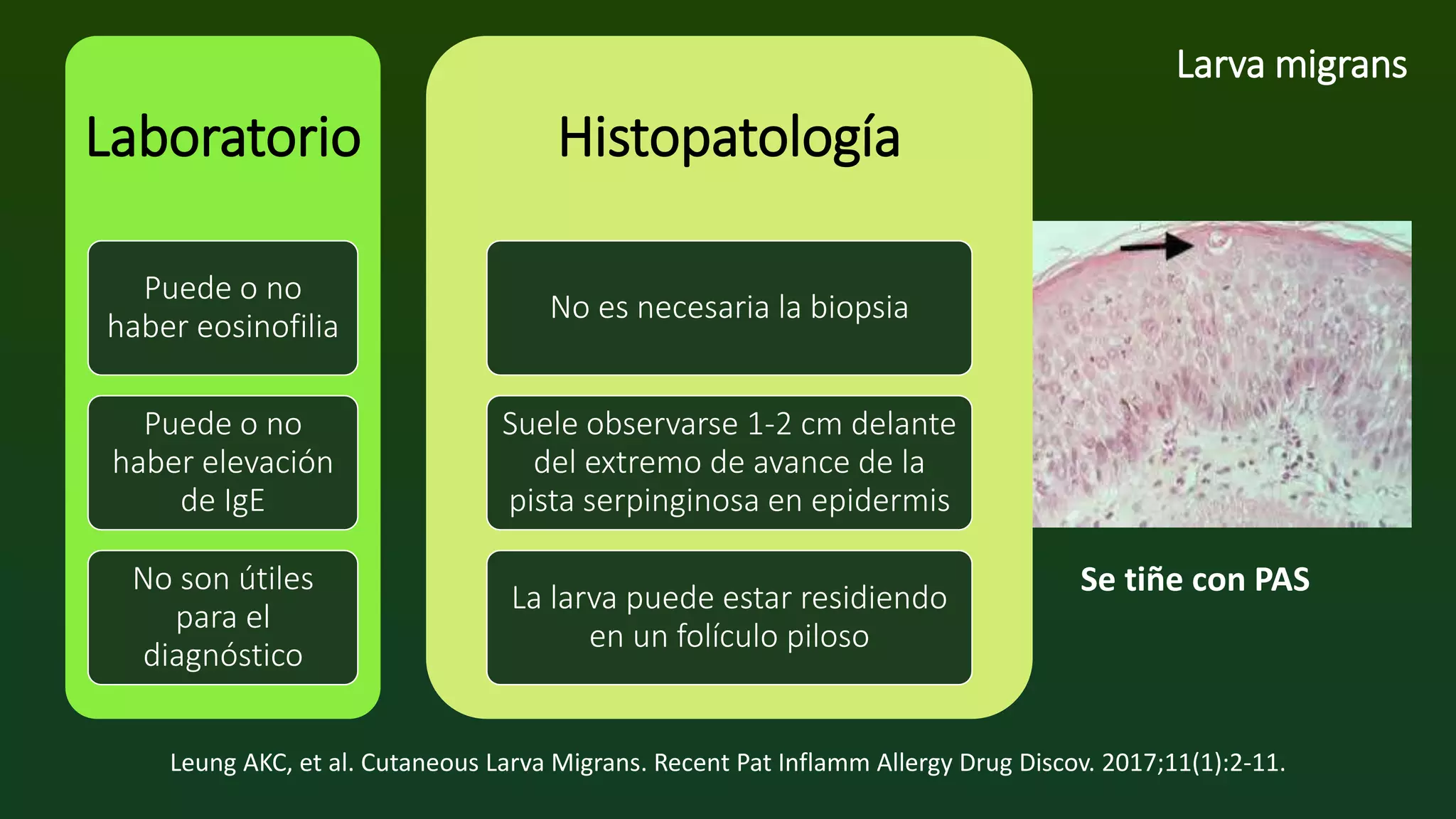 Larva Migrans | PPTX