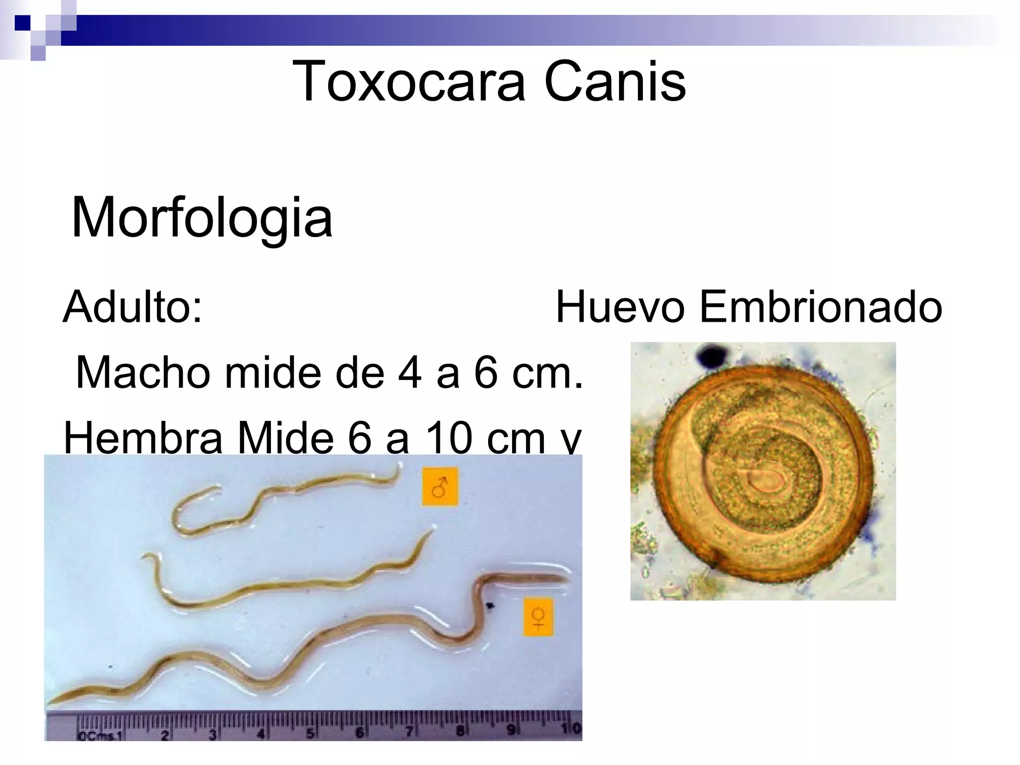 Larva migrans visceral y cutanea
