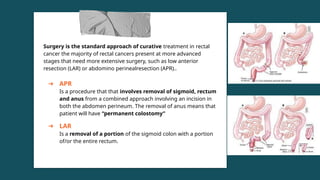 Comparison of abdominoperineal resection and low anterior resection in ...