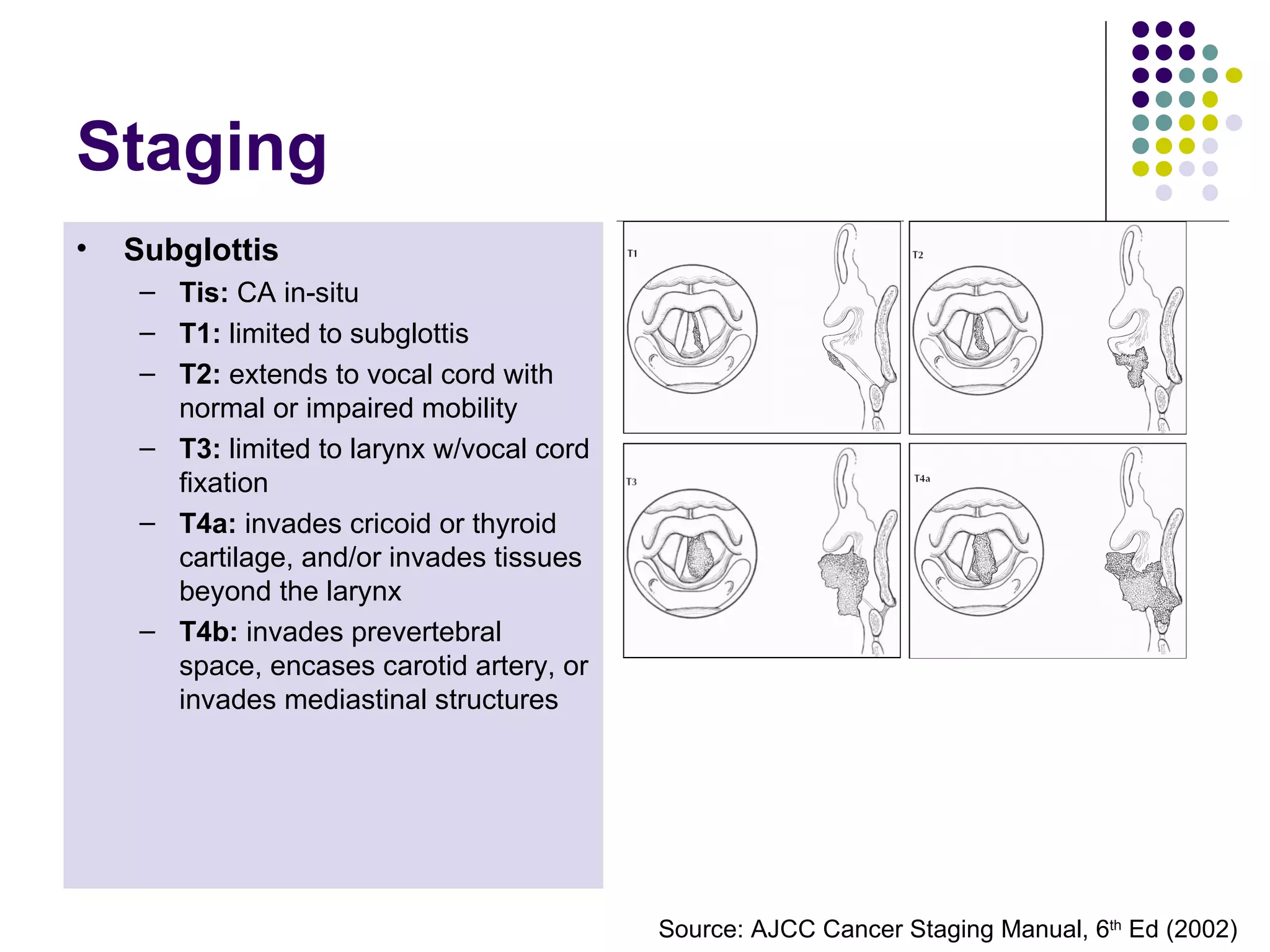 Laryngeal Cancer | PPT