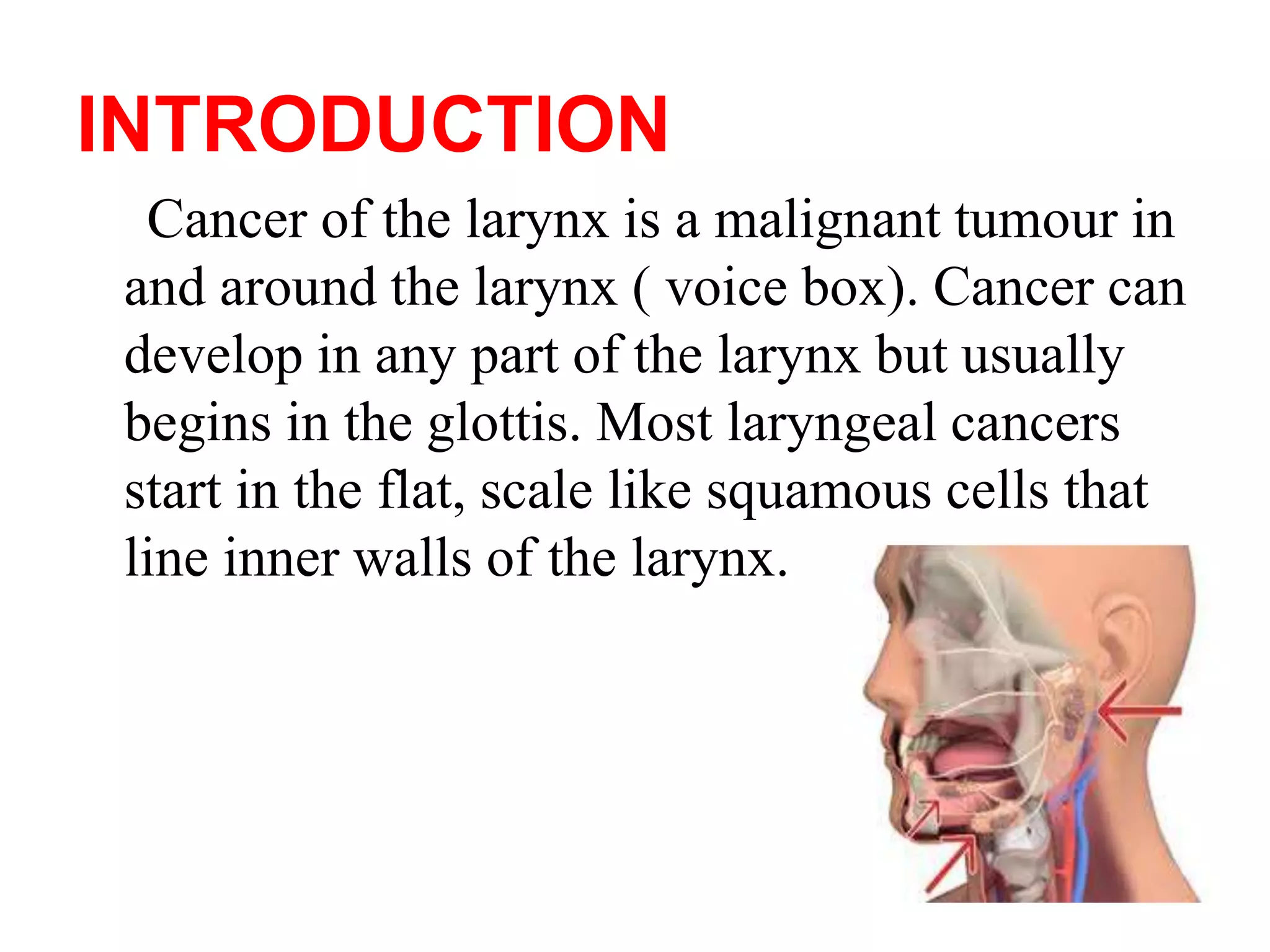 Laryngeal Cancer | PPTX