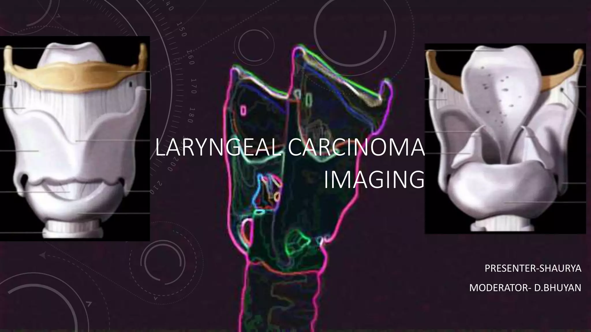 Laryngeal carcinoma Imaging | PPTX