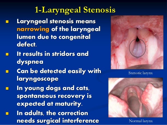 Laryngeal diseases