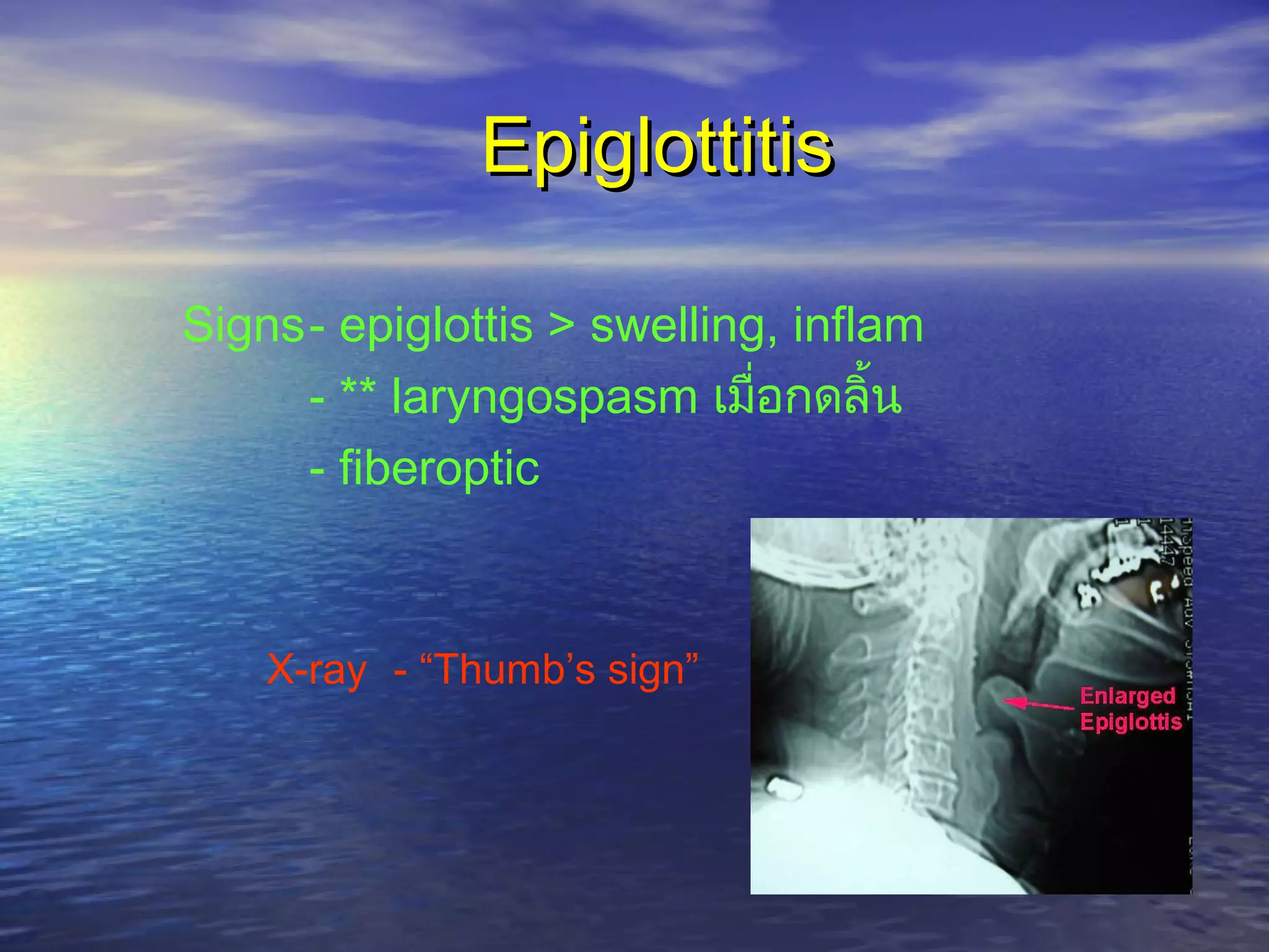 Laryngealdisorders | PPT