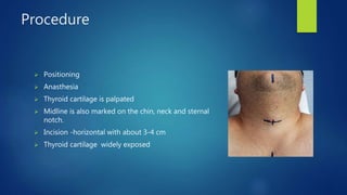 Laryngeal framework surgery | PPTX