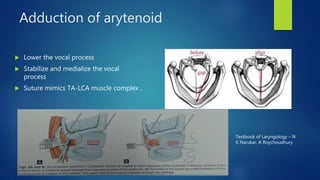 Laryngeal framework surgery | PPTX