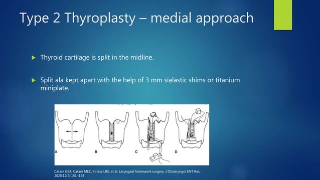 Laryngeal framework surgery | PPTX