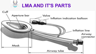 Laryngeal Mask-WPS Office.pptx