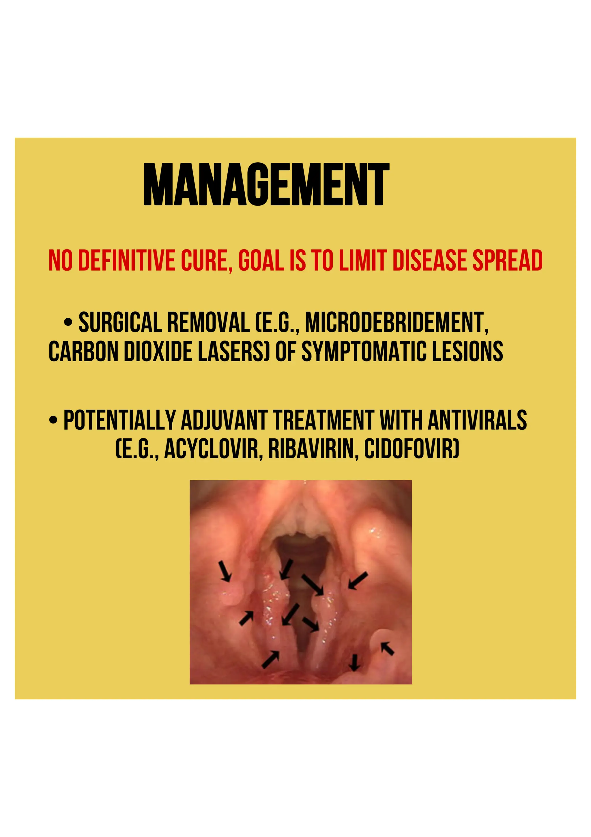 Laryngeal papillomatosis .pdf ENT BY QUICKMEDTALK | PDF