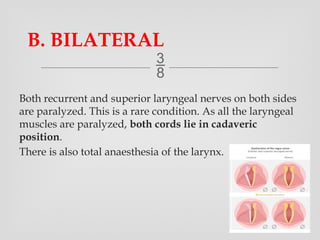 types of laryngeal Paralysis Ear Nose Throat.pptx