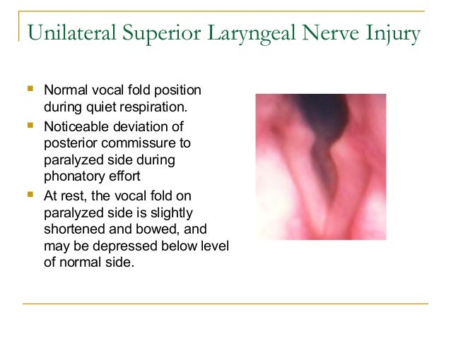 Laryngeal paralysis final