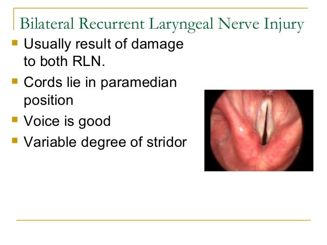 Laryngeal paralysis final