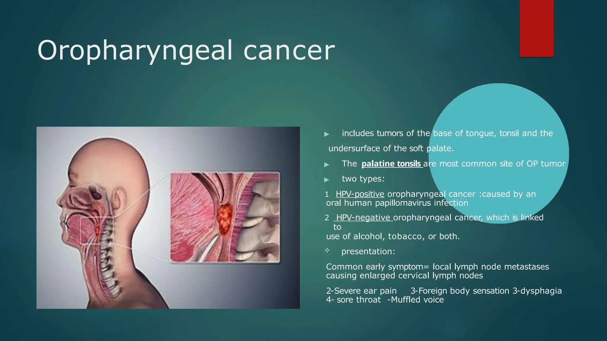 Laryngeal & pharyngeal cancer ENT .pptx