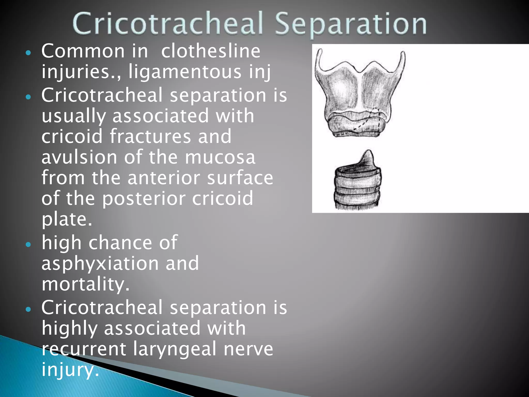 Laryngeal trauma | PPTX