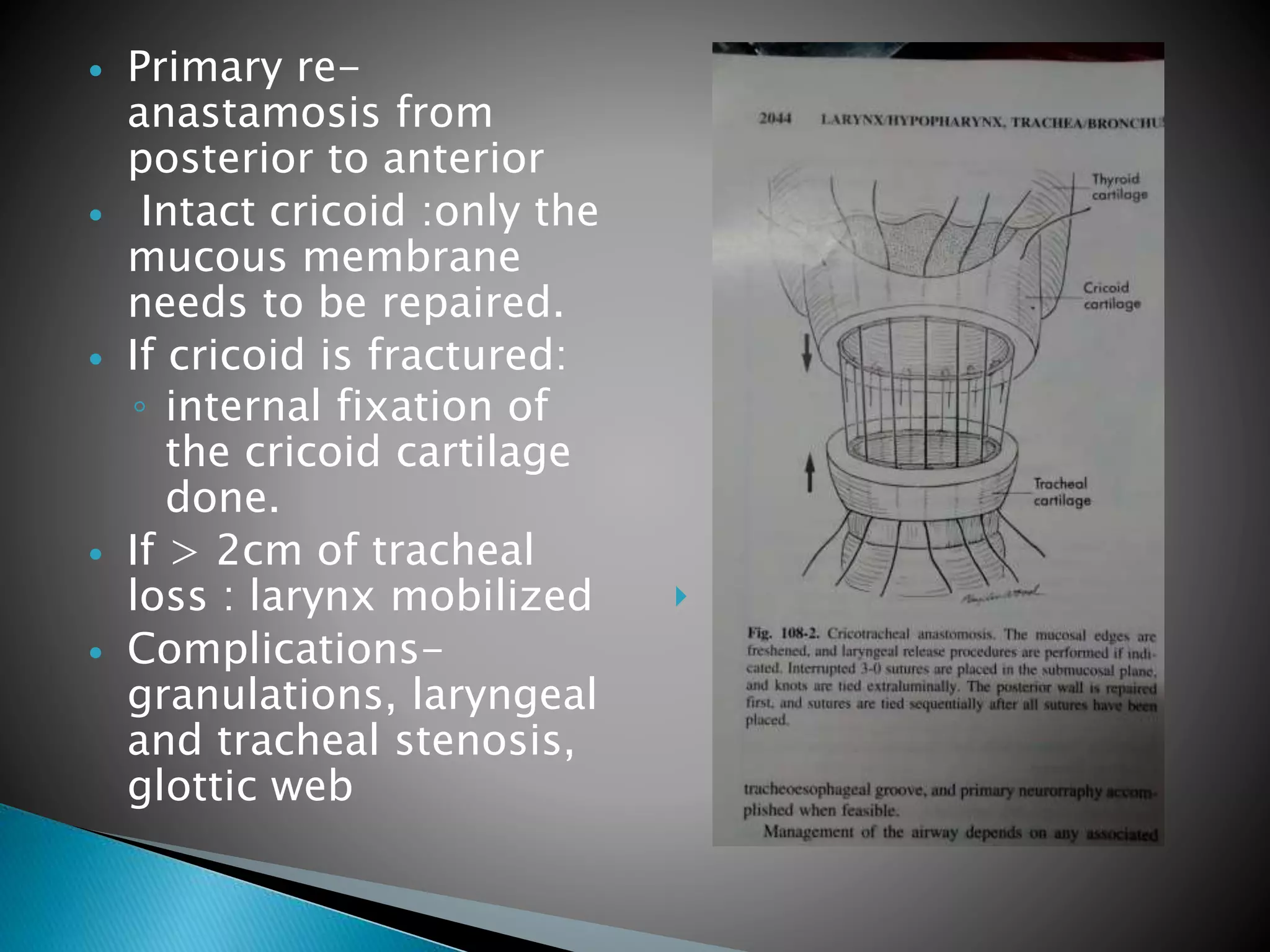 Laryngeal trauma | PPTX