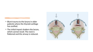 laryngotracheal trauma by dr syafiqah kamel | PPT