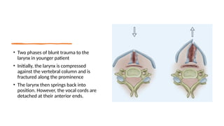 laryngotracheal trauma by dr syafiqah kamel | PPT