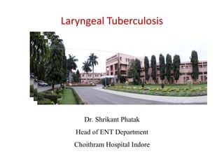 Laryngeal tuberculosis | PPTX