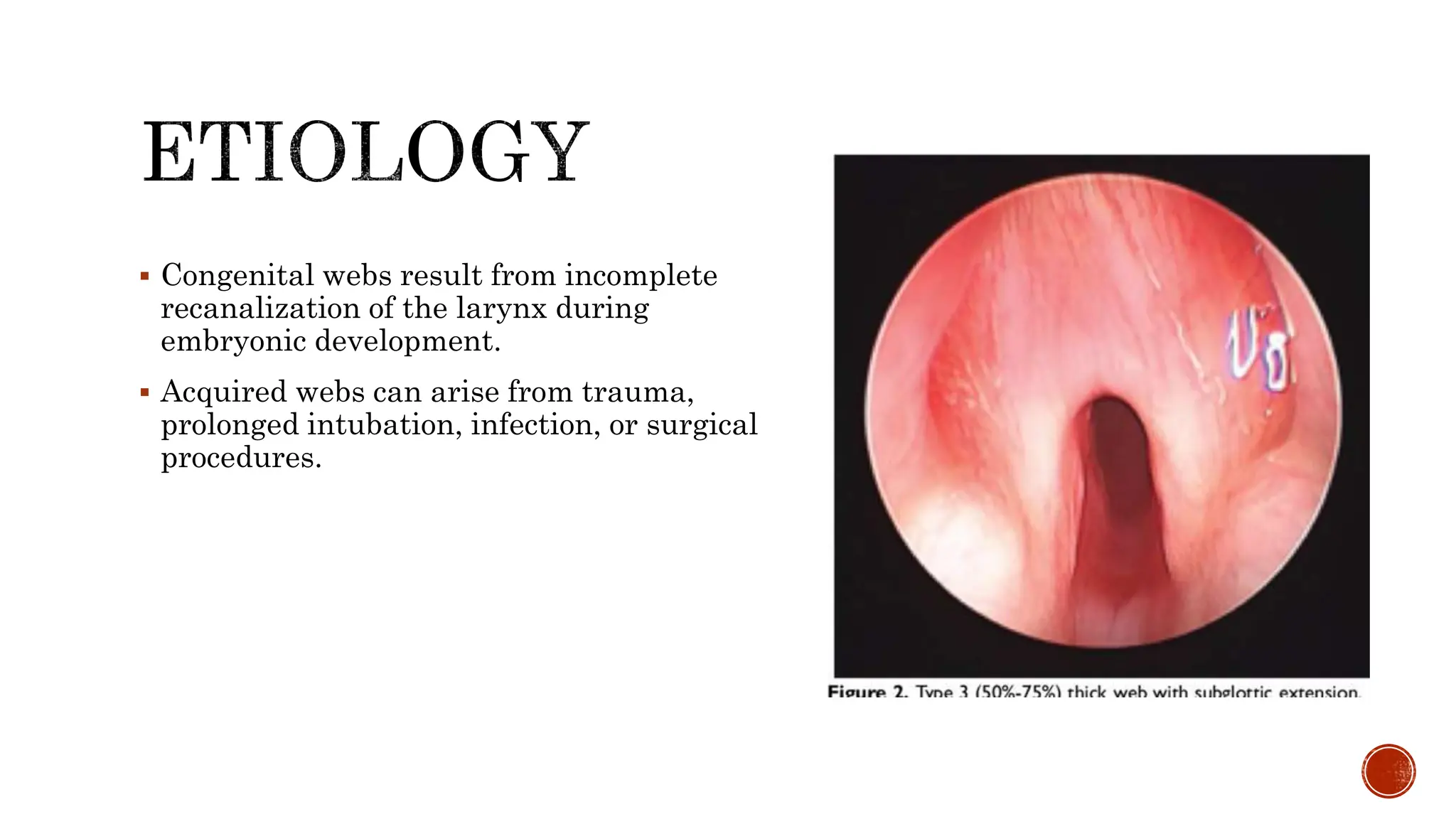LARYNGEAL WEBS AND SUBGLOTTIC HEMANGIOMA.pptx