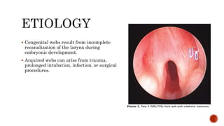 LARYNGEAL WEBS AND SUBGLOTTIC HEMANGIOMA.pptx