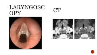 LARYNGEAL WEBS AND SUBGLOTTIC HEMANGIOMA.pptx