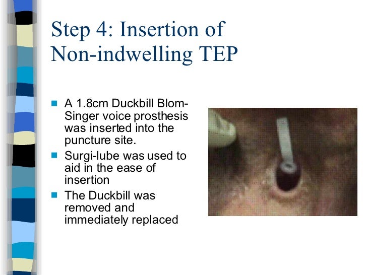 Laryngectomy Rehabiliation1