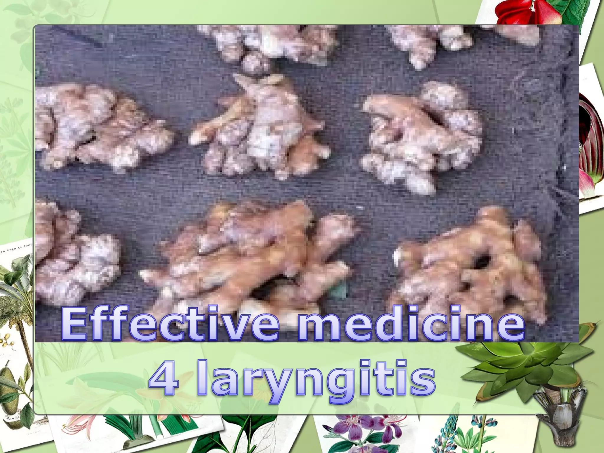 Laryngitis | PPT